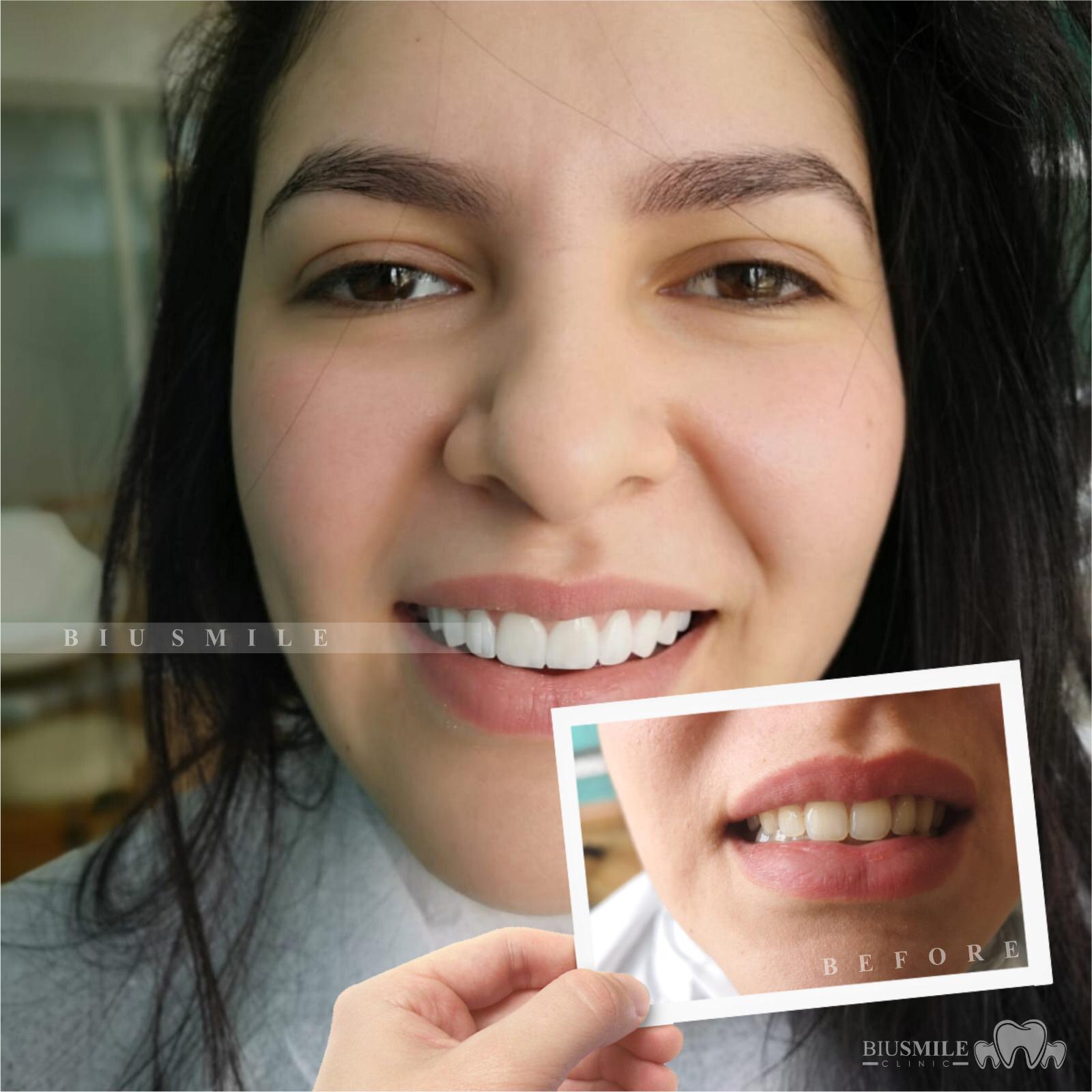 Home - biusmile